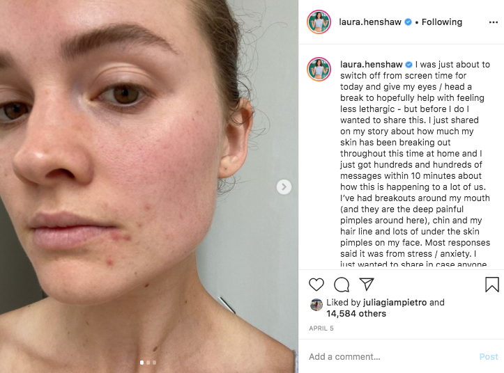 Is your skin freaking out right now? Here's why | Girlfriend