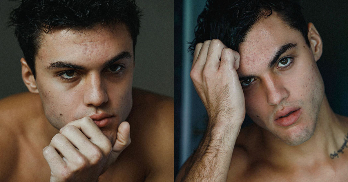 Youtuber Ethan Dolan Shared A Powerful Message About His Struggle With ...